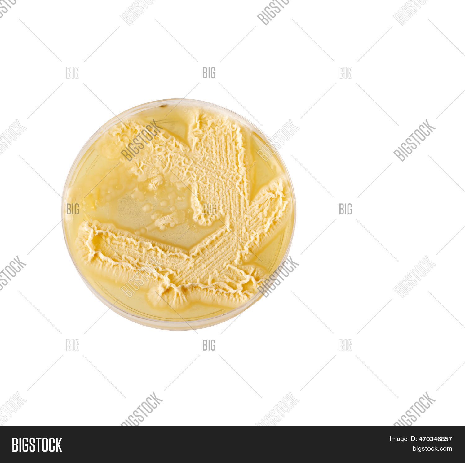 Unicellular Fungi Image & Photo (Free Trial) | Bigstock