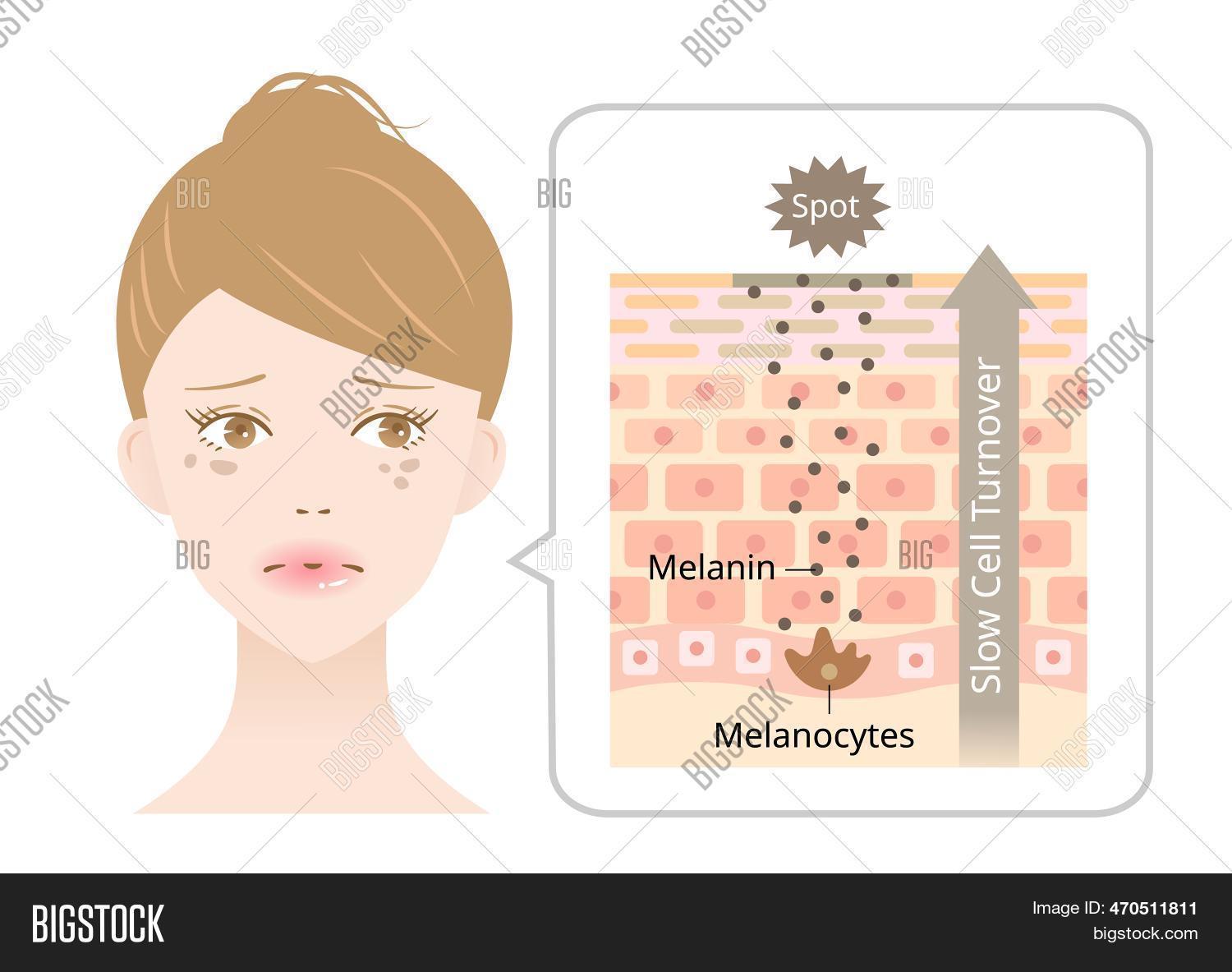 Skin Cell Turnover Image & Photo (Free Trial) | Bigstock