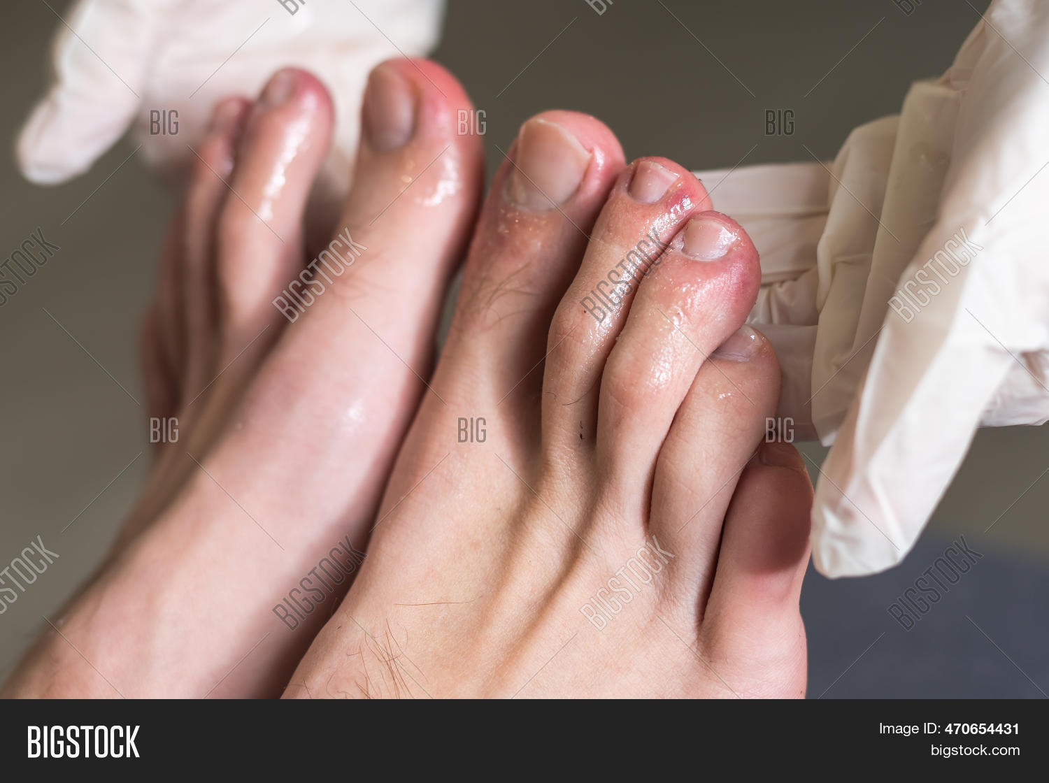 Mans Toes Showing What Image & Photo (Free Trial) | Bigstock