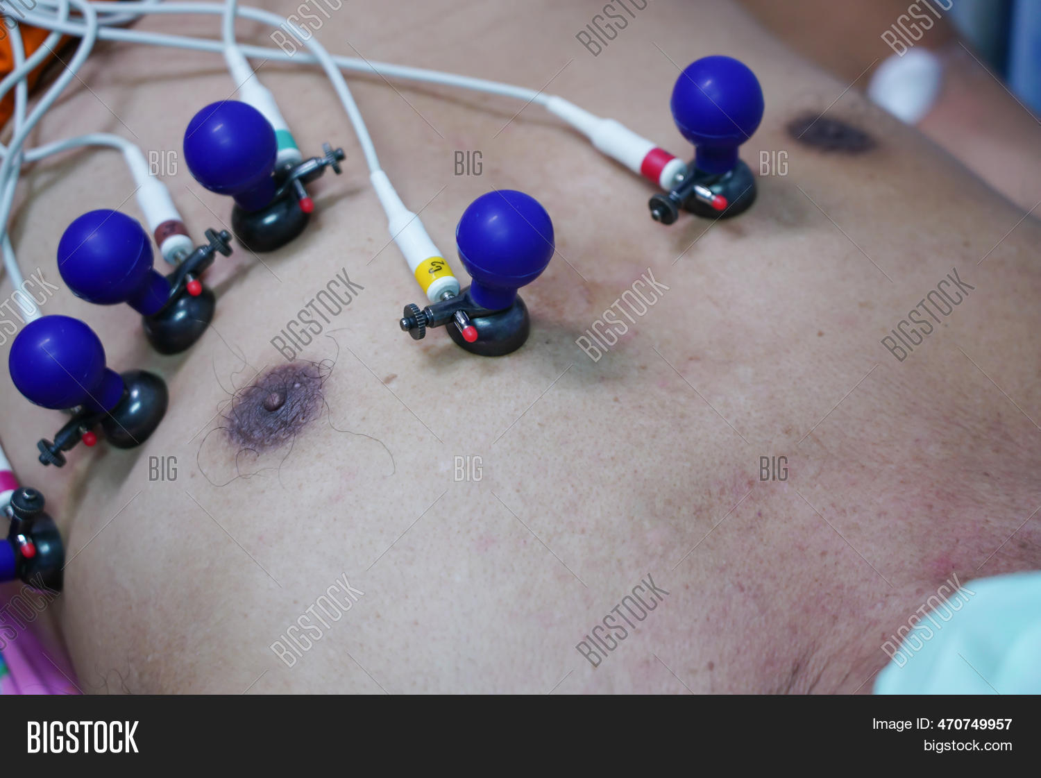 Ecg Ekg Man Electrodes Image & Photo (Free Trial) | Bigstock