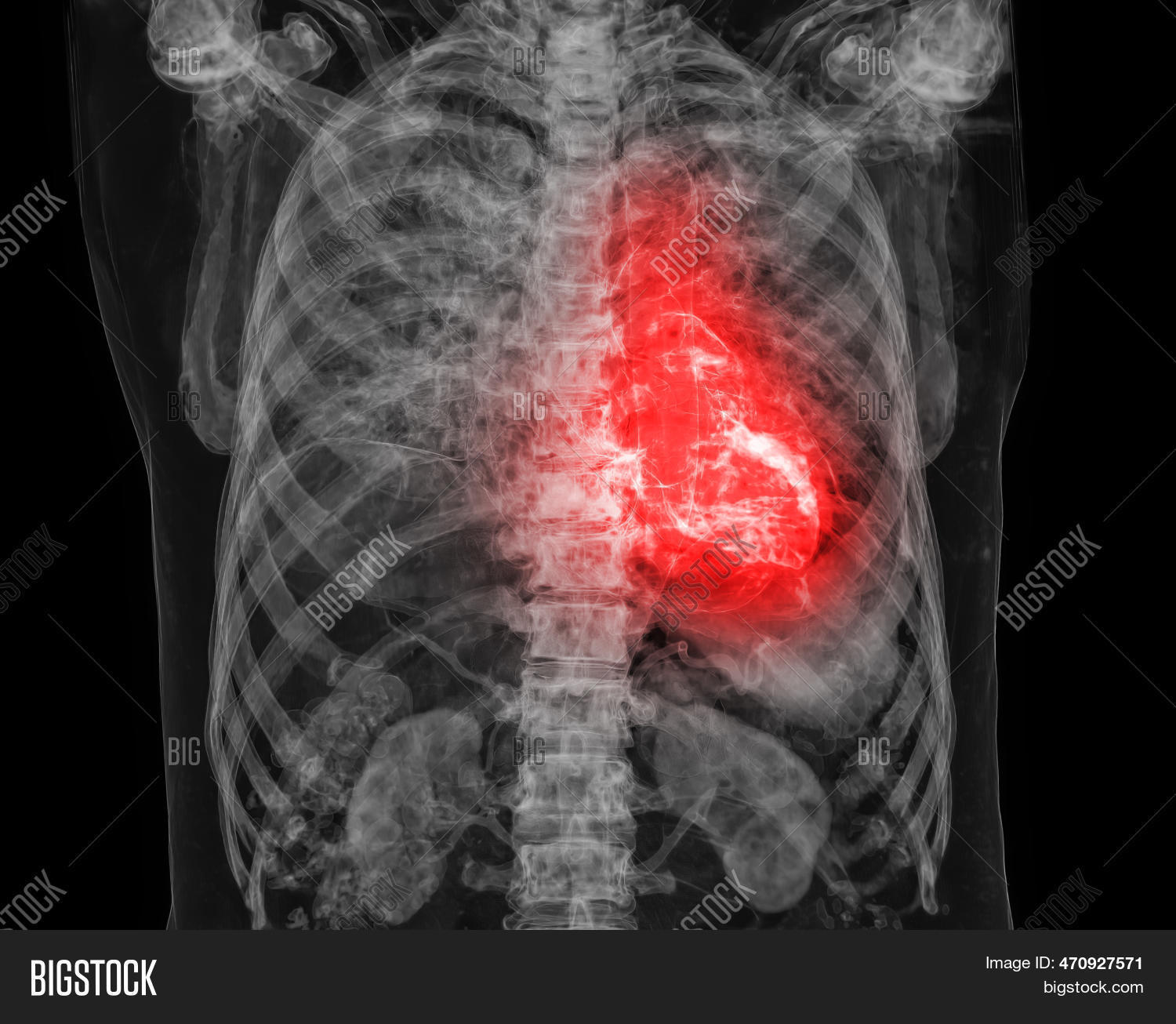 Human Heart Attack Image & Photo (Free Trial) | Bigstock