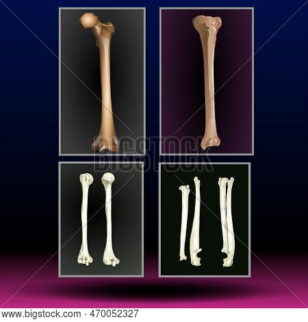 Leg Bones - Bones Leg Image & Photo (Free Trial) | Bigstock