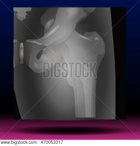 X-ray Deformities - Image & Photo (Free Trial) | Bigstock