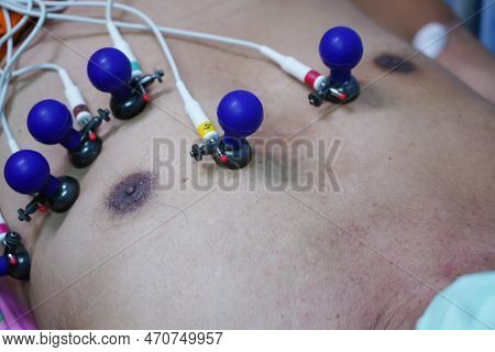 Ecg Ekg Man Electrodes Image & Photo (Free Trial) | Bigstock