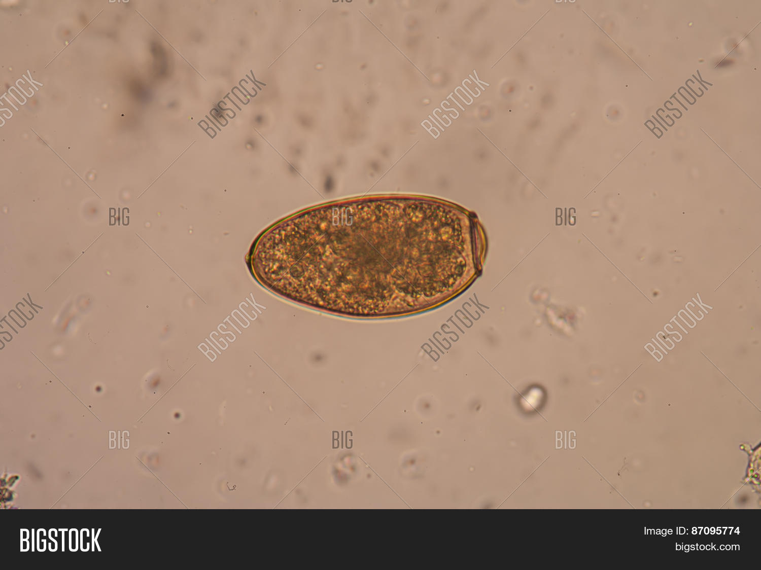 Numerous Trematodes Image & Photo (Free Trial) | Bigstock