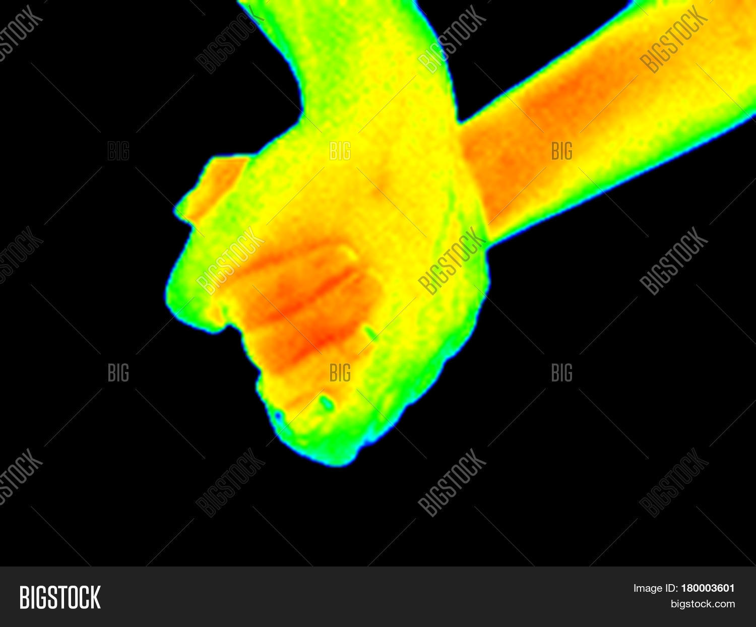 Thermographic Image Image & Photo (Free Trial) | Bigstock