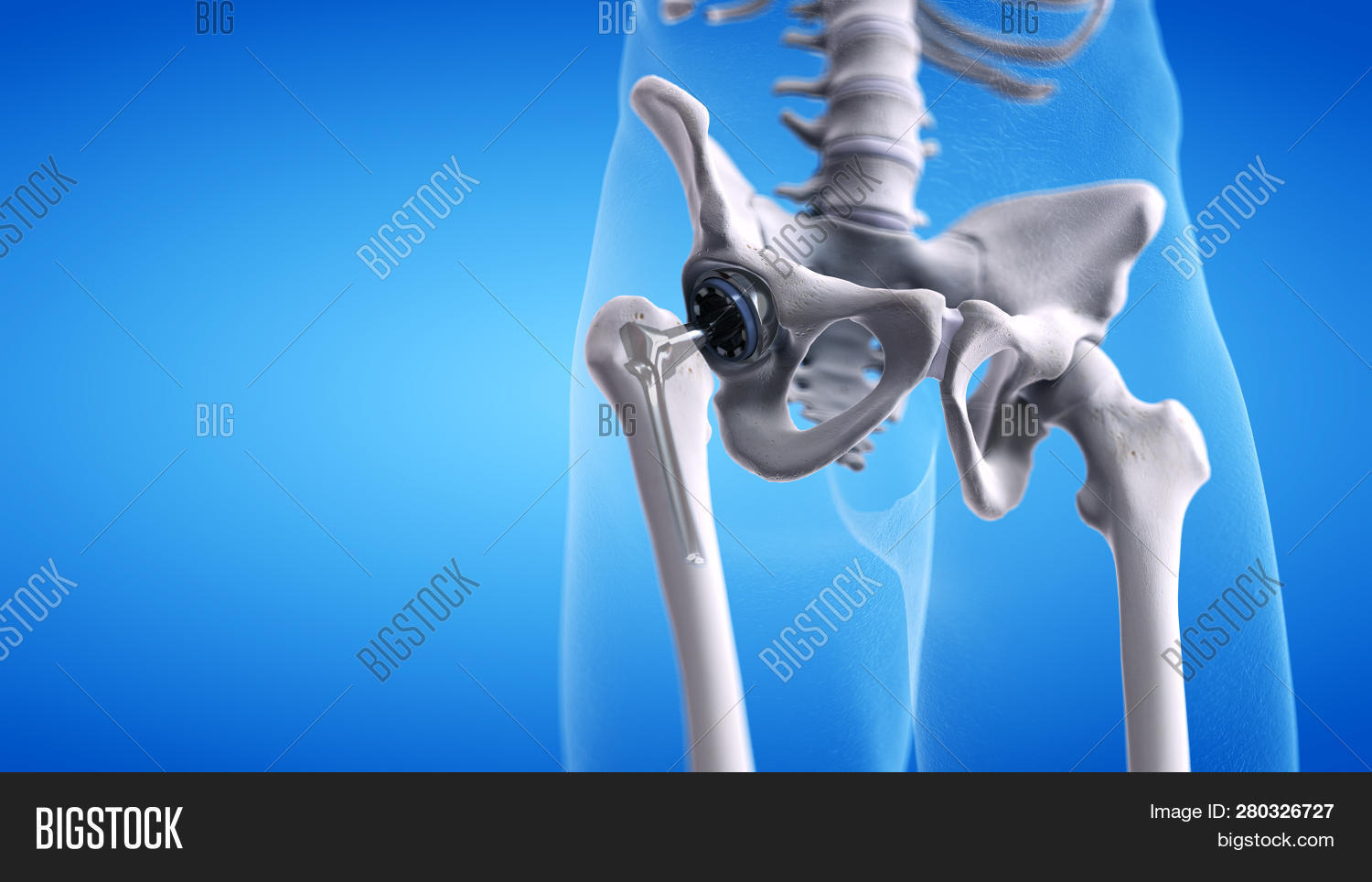3d Rendered Medically Image & Photo (Free Trial) | Bigstock