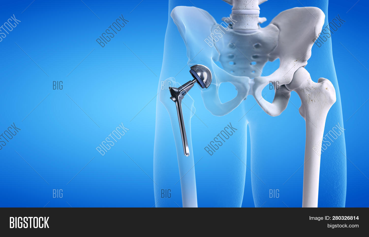3d Rendered Medically Image & Photo (Free Trial) | Bigstock
