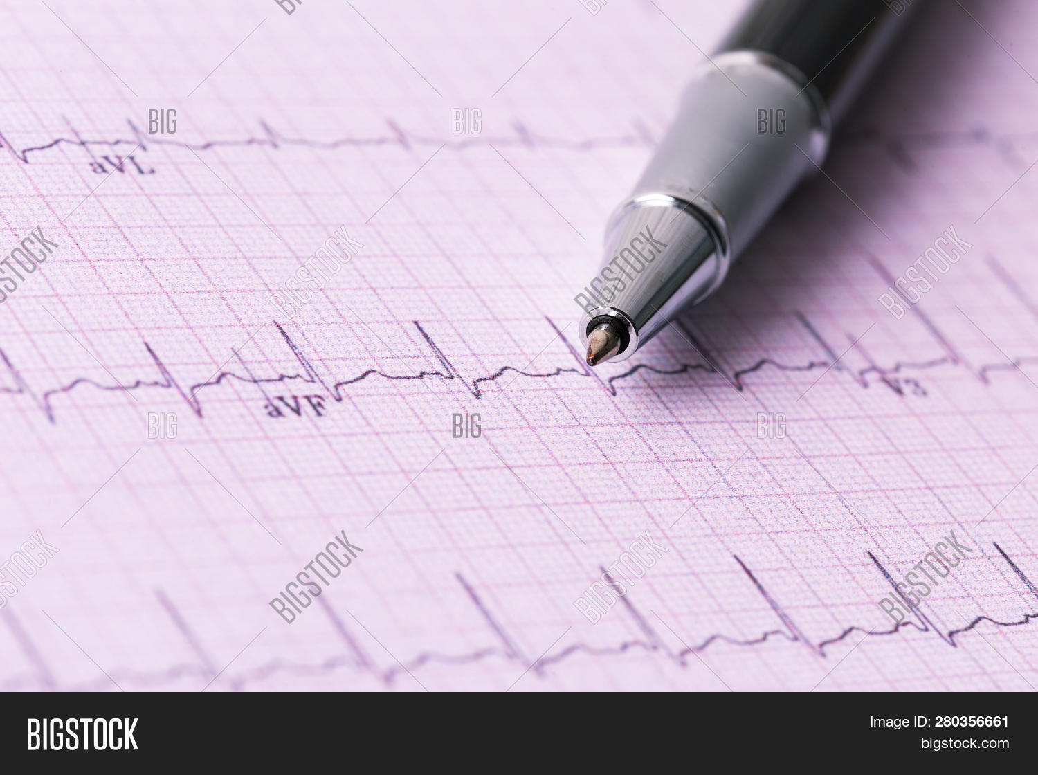 Cardiogram Technical Image & Photo (Free Trial) | Bigstock