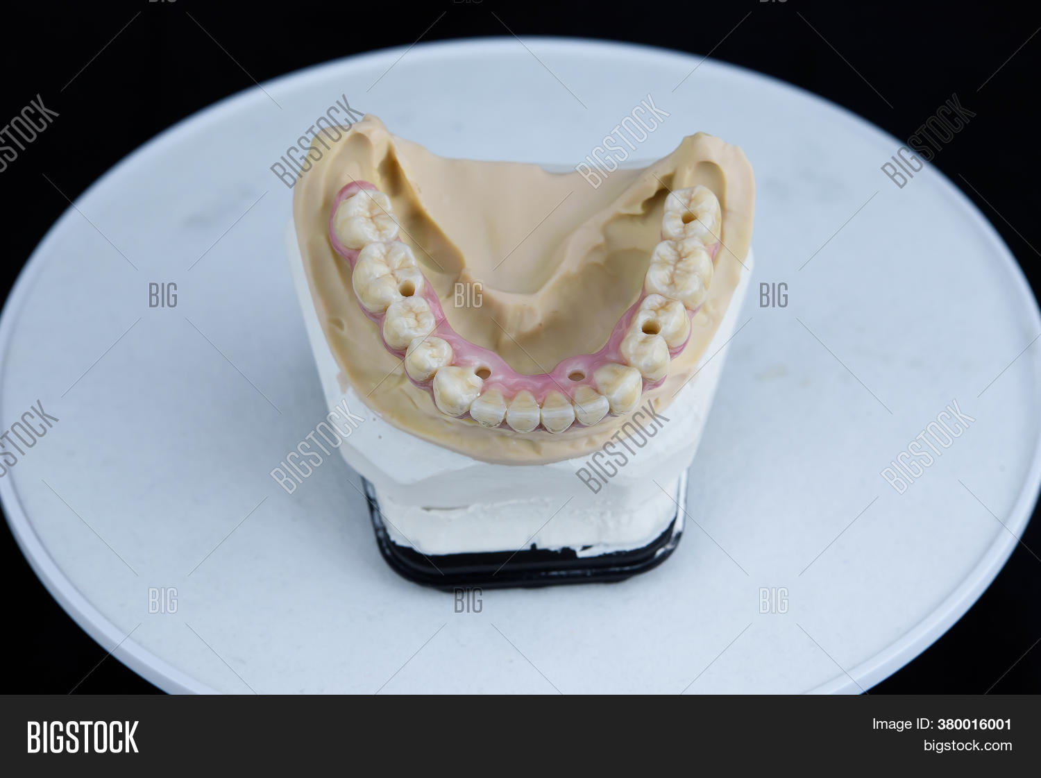 Teeth Ceramics Image & Photo (Free Trial) | Bigstock