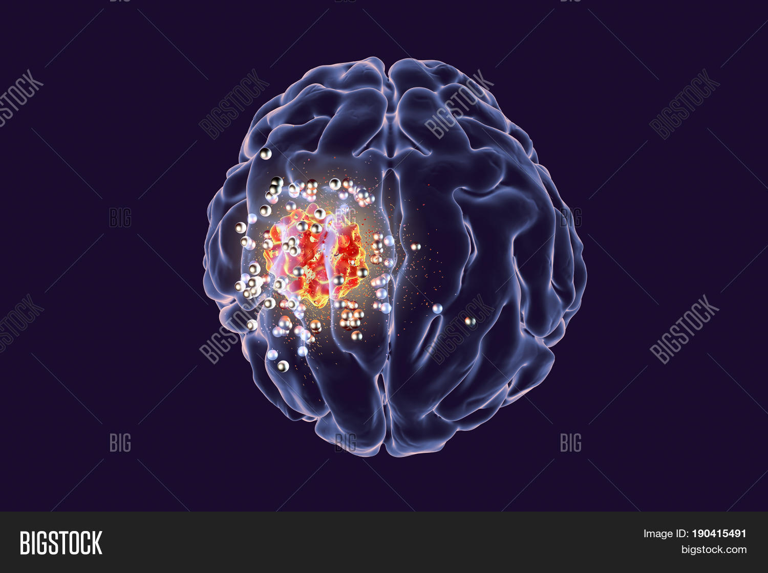 Destruction Brain Image & Photo (Free Trial) | Bigstock