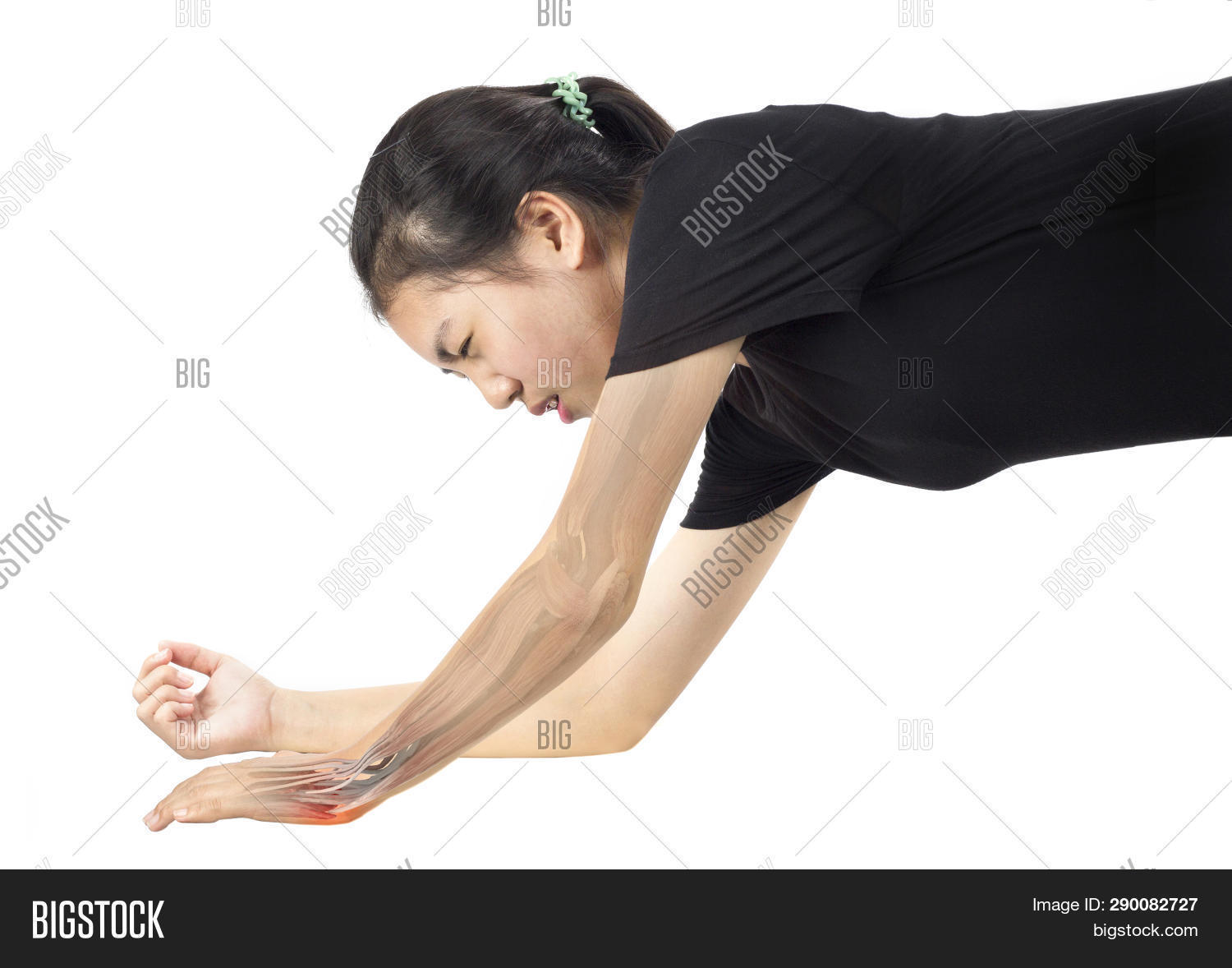 Wrist Muscle Pain Image & Photo (Free Trial) | Bigstock