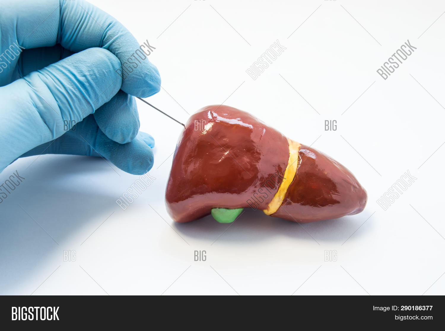 Concept Photo Liver Image & Photo (Free Trial) | Bigstock
