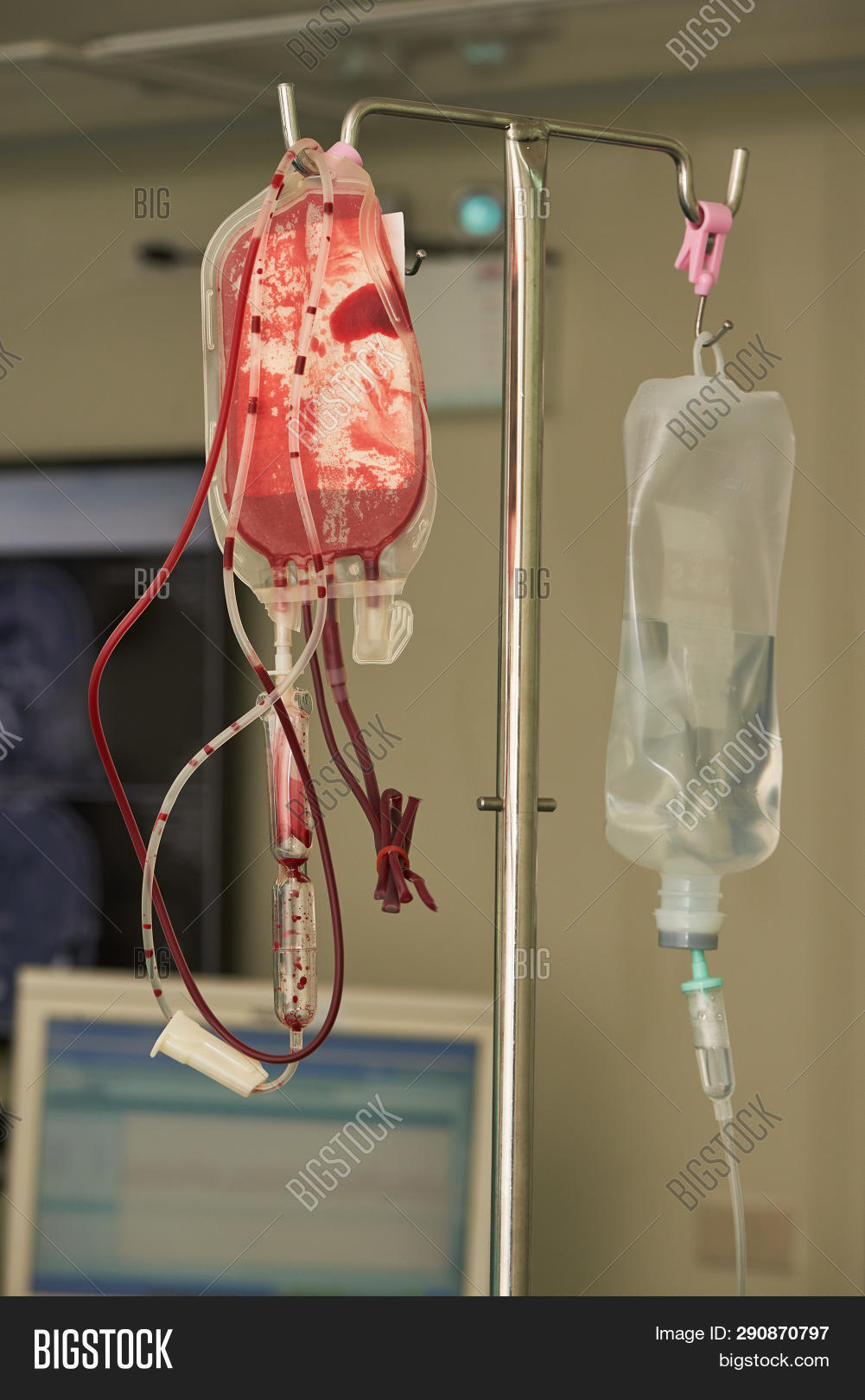 Injecting Saline Into Your Sac