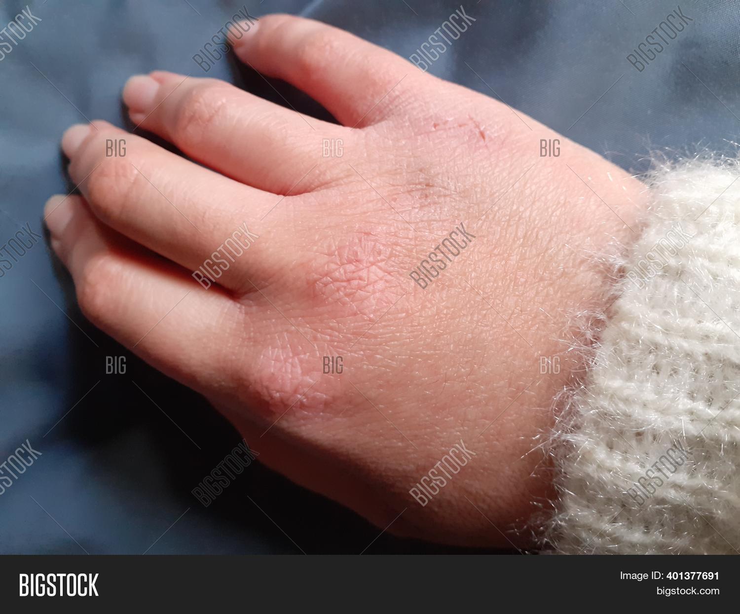 Closeup Woman's Hand Image & Photo (Free Trial) | Bigstock