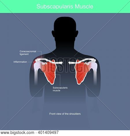 Subscapularis Muscle Vector & Photo (Free Trial) | Bigstock