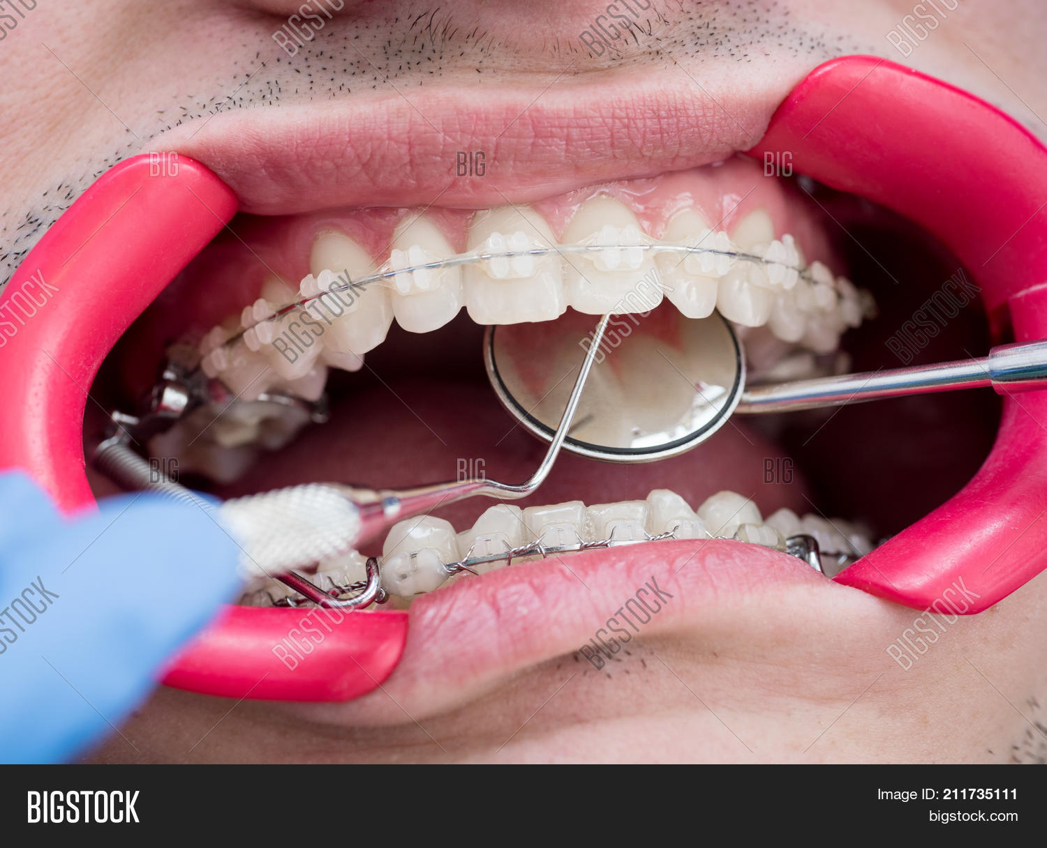 Dentist Holding Probe Image & Photo (Free Trial) | Bigstock