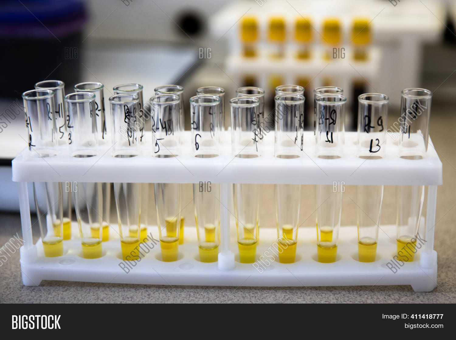 Study Blood Serum Test Image & Photo (Free Trial) | Bigstock