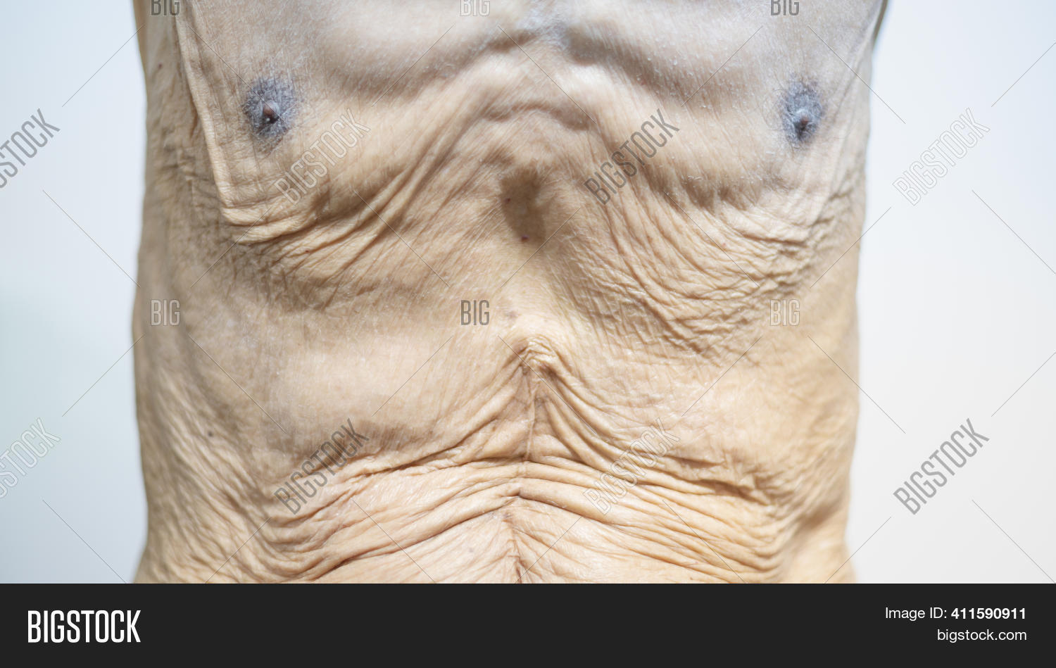 Thin Old Man Skin Image & Photo (Free Trial) | Bigstock