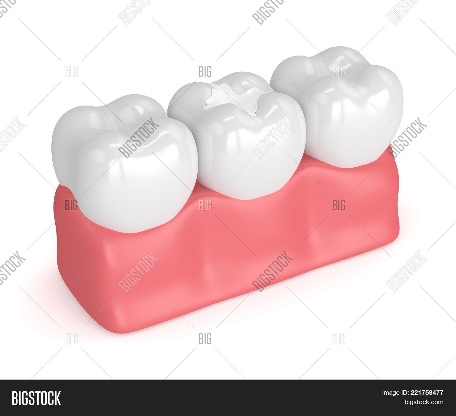 3d Render Teeth Dental Image & Photo (Free Trial) | Bigstock