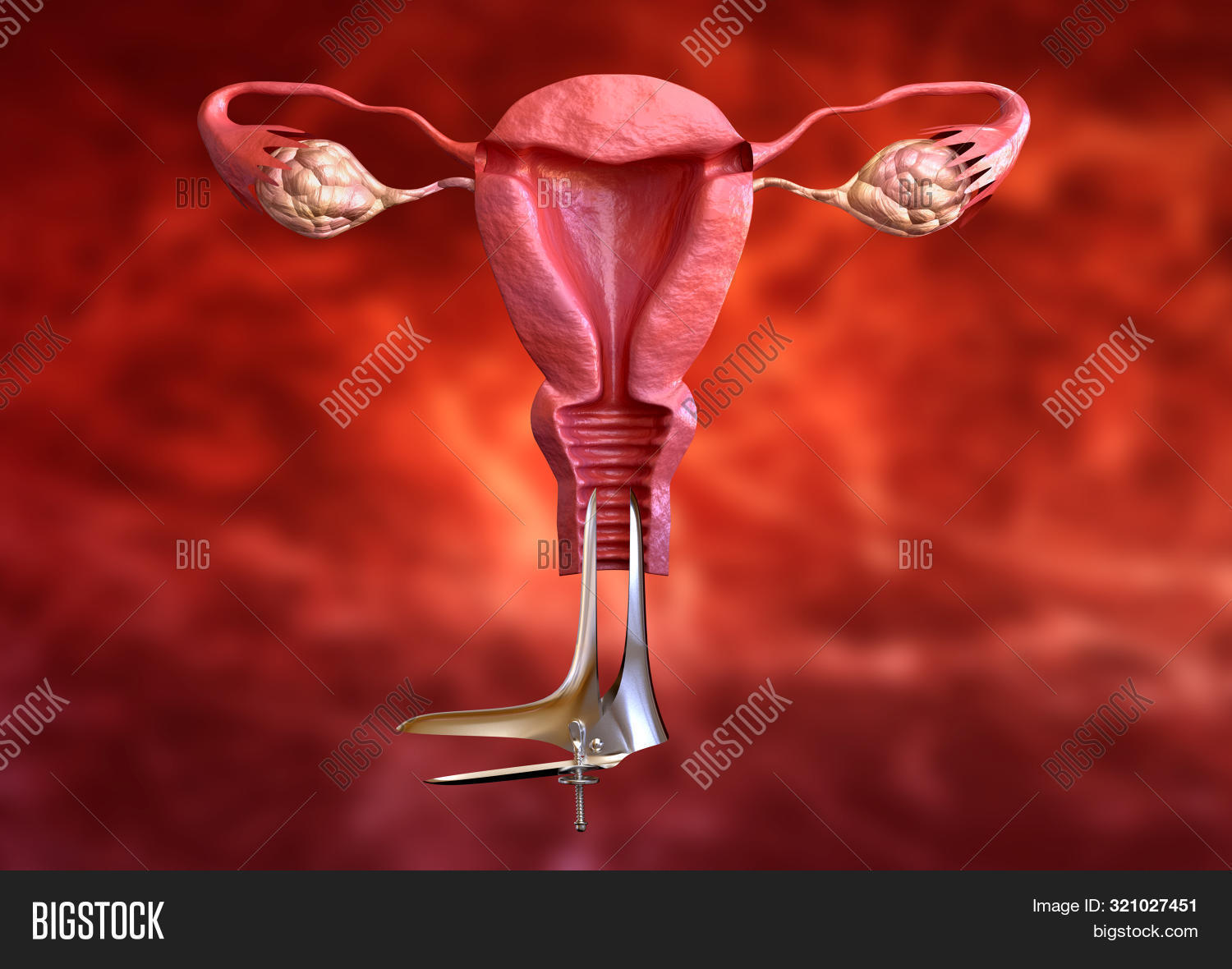 Pap Smear Image & Photo (Free Trial) | Bigstock