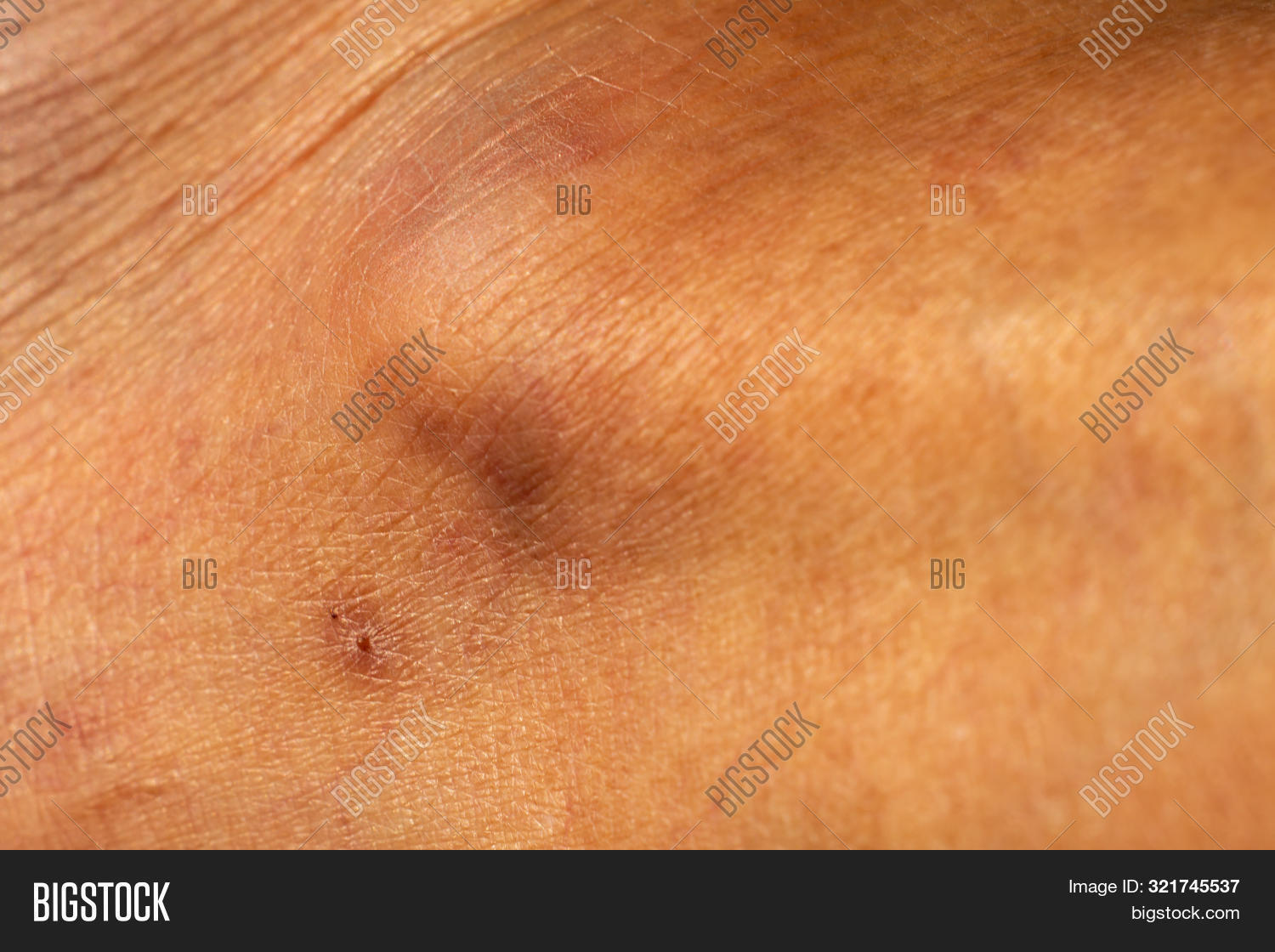 Woman's Scratch Dry Image & Photo (Free Trial) | Bigstock