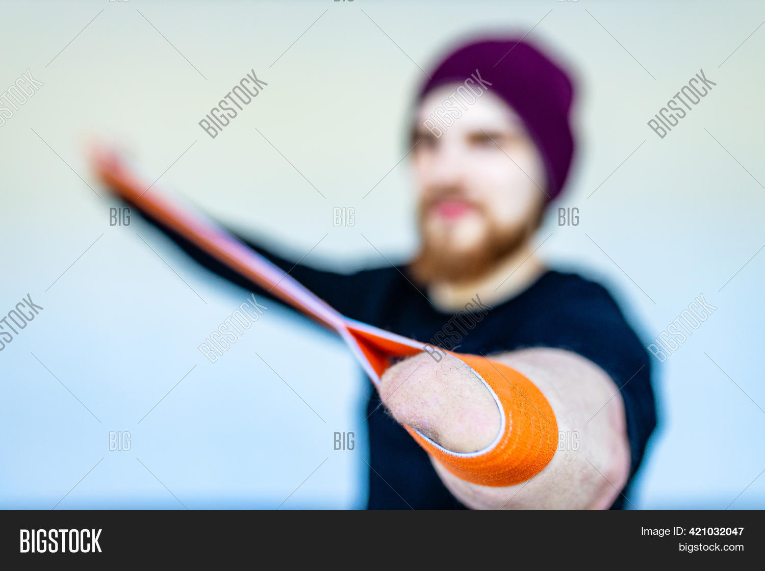 Man Amputee Hand Image & Photo (Free Trial) | Bigstock