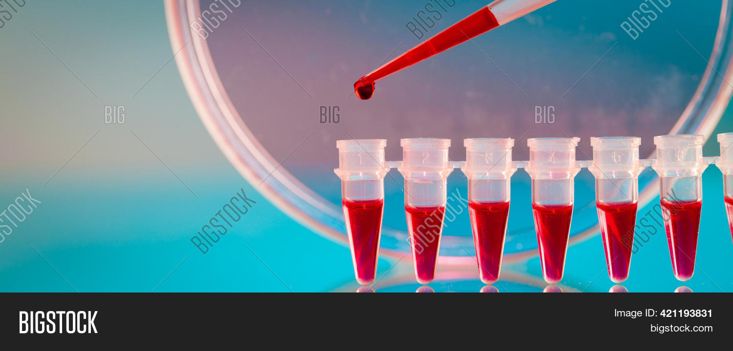 Pipette Pcr Strip PCR Image & Photo (Free Trial) | Bigstock