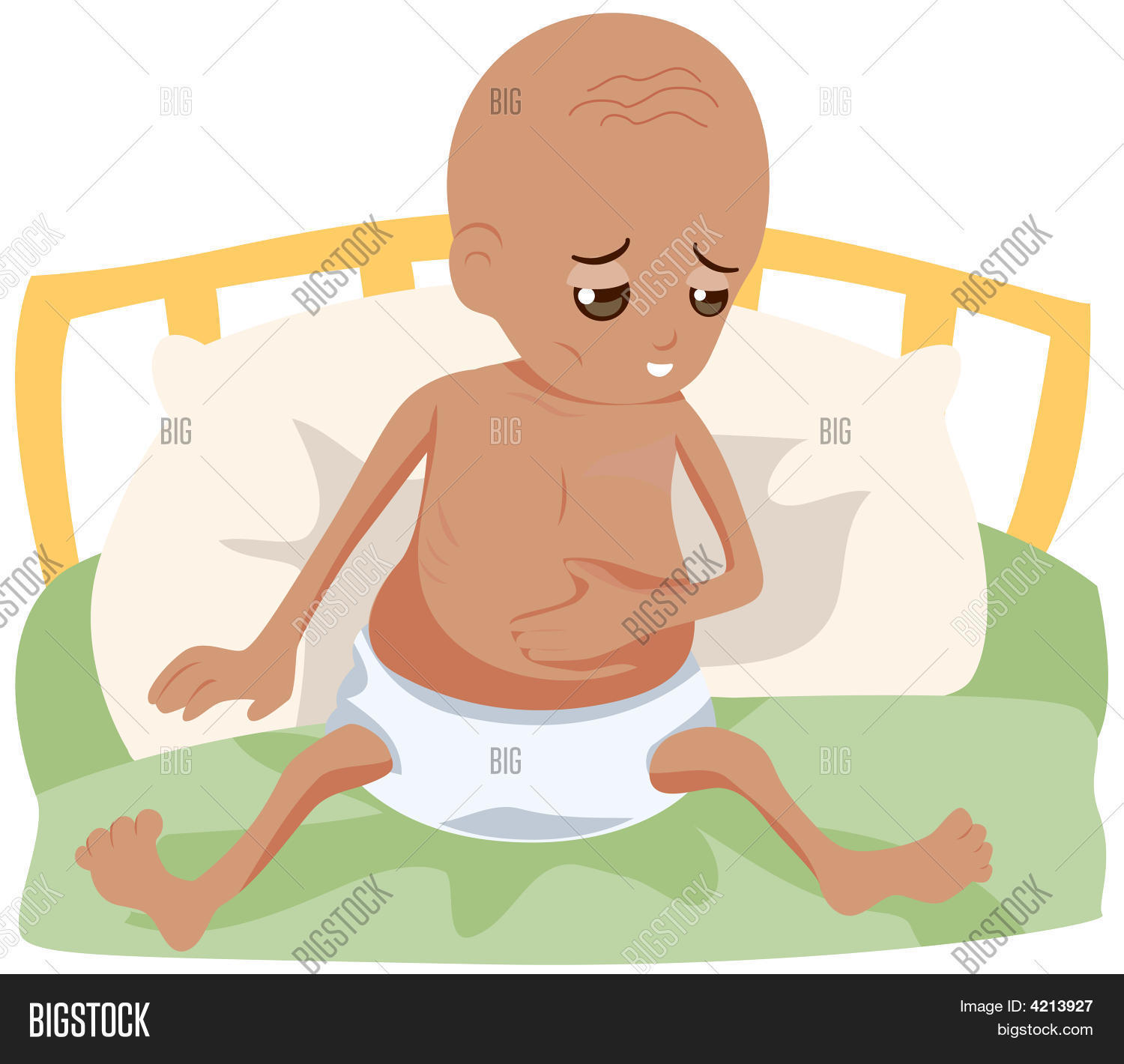 Malnourished Child Image & Photo (Free Trial) | Bigstock