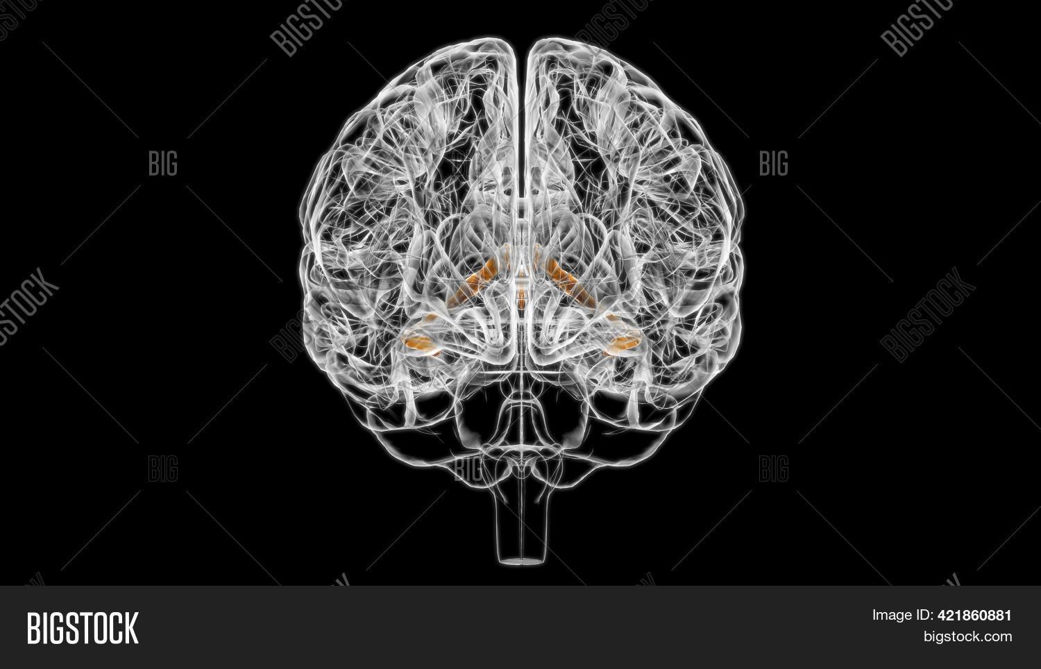 Brain Choroid Plexus Image & Photo (Free Trial) | Bigstock