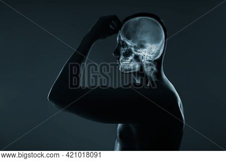 X-ray Man's Head. Image & Photo (Free Trial) | Bigstock