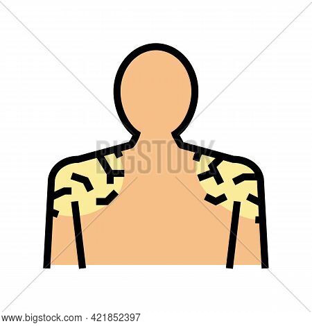 Shoulders Dry Skin Vector & Photo (Free Trial) | Bigstock
