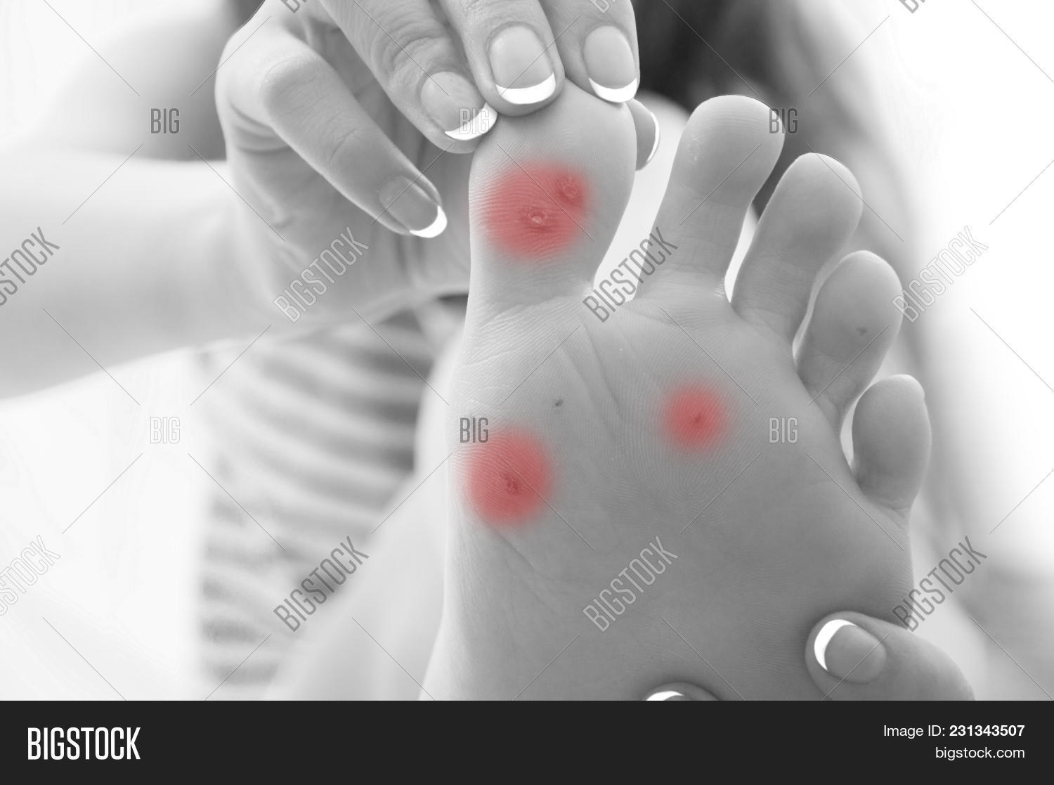Girl Shows Doctor Foot Image & Photo (Free Trial) | Bigstock