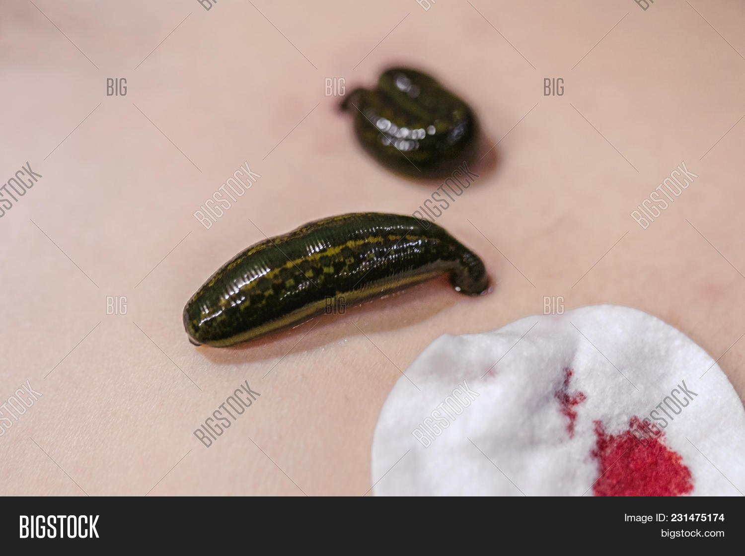 Close Medical Leeches Image & Photo (Free Trial) | Bigstock