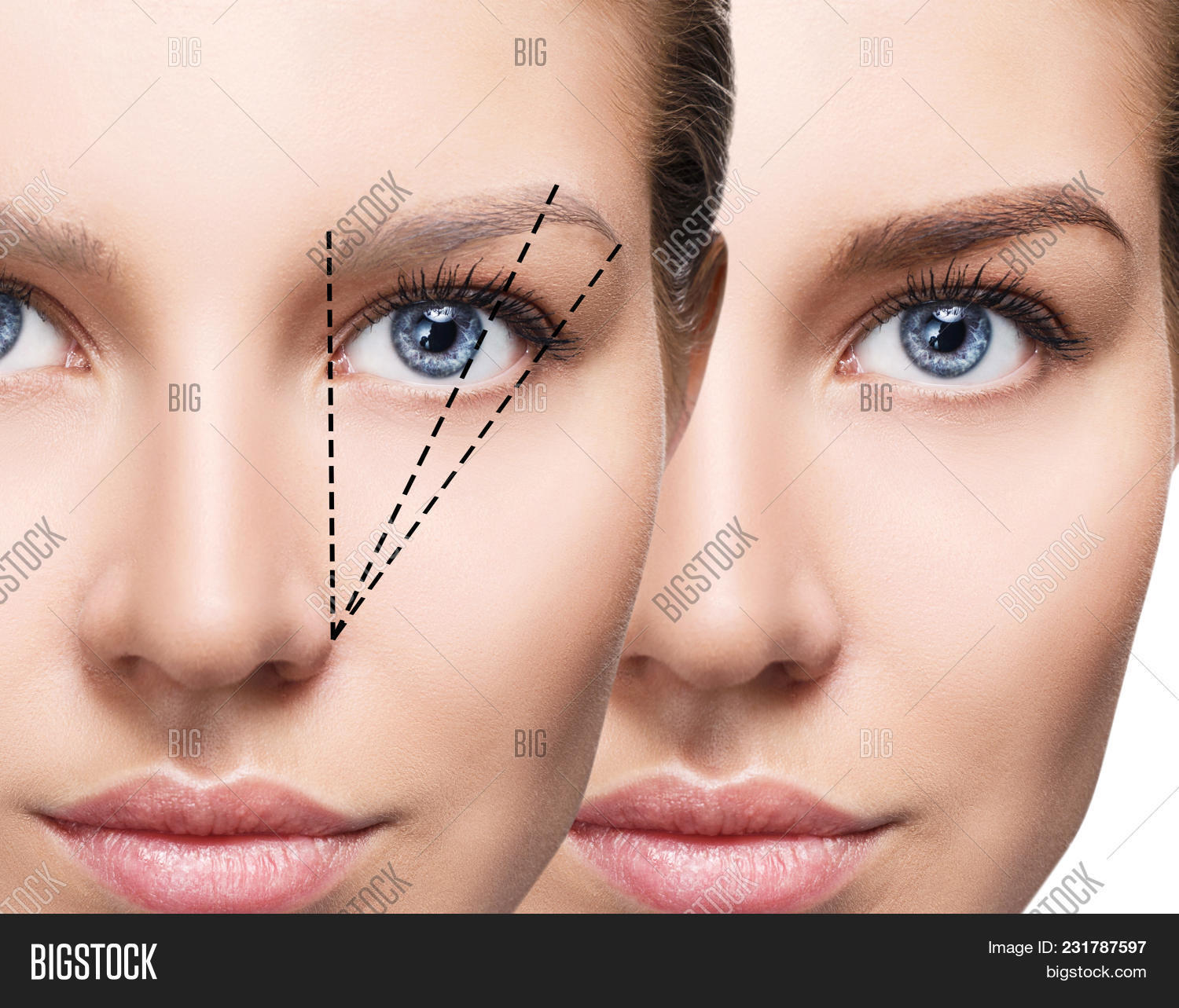 Eyebrows Correction. Image & Photo (Free Trial) | Bigstock