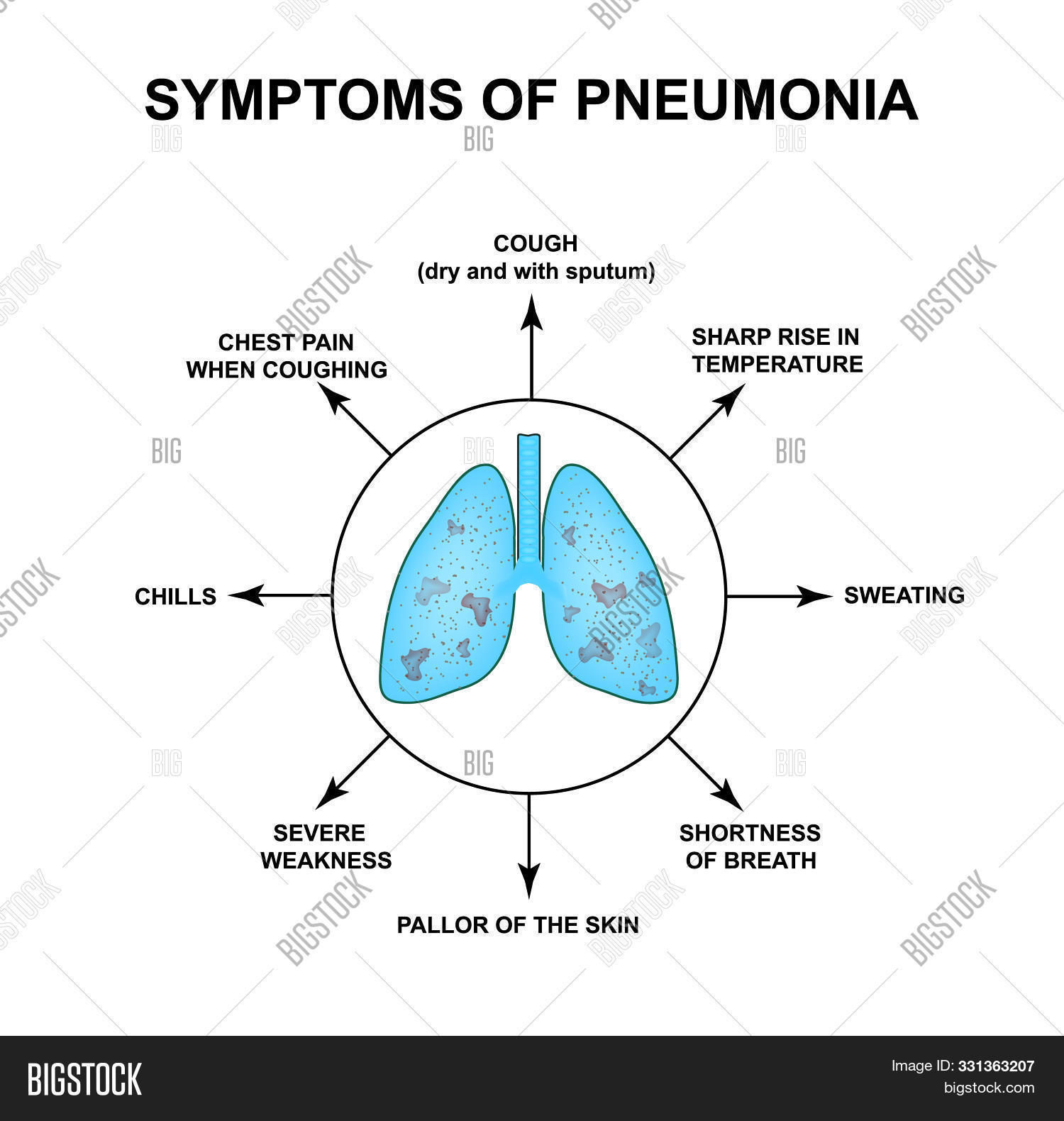 Symptoms Pneumonia. Image & Photo (Free Trial) | Bigstock
