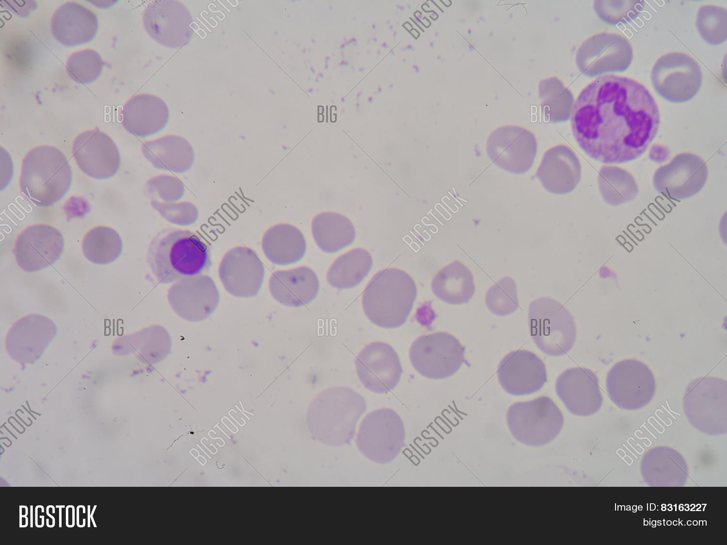 Blood Smear Beta Image & Photo (Free Trial) | Bigstock