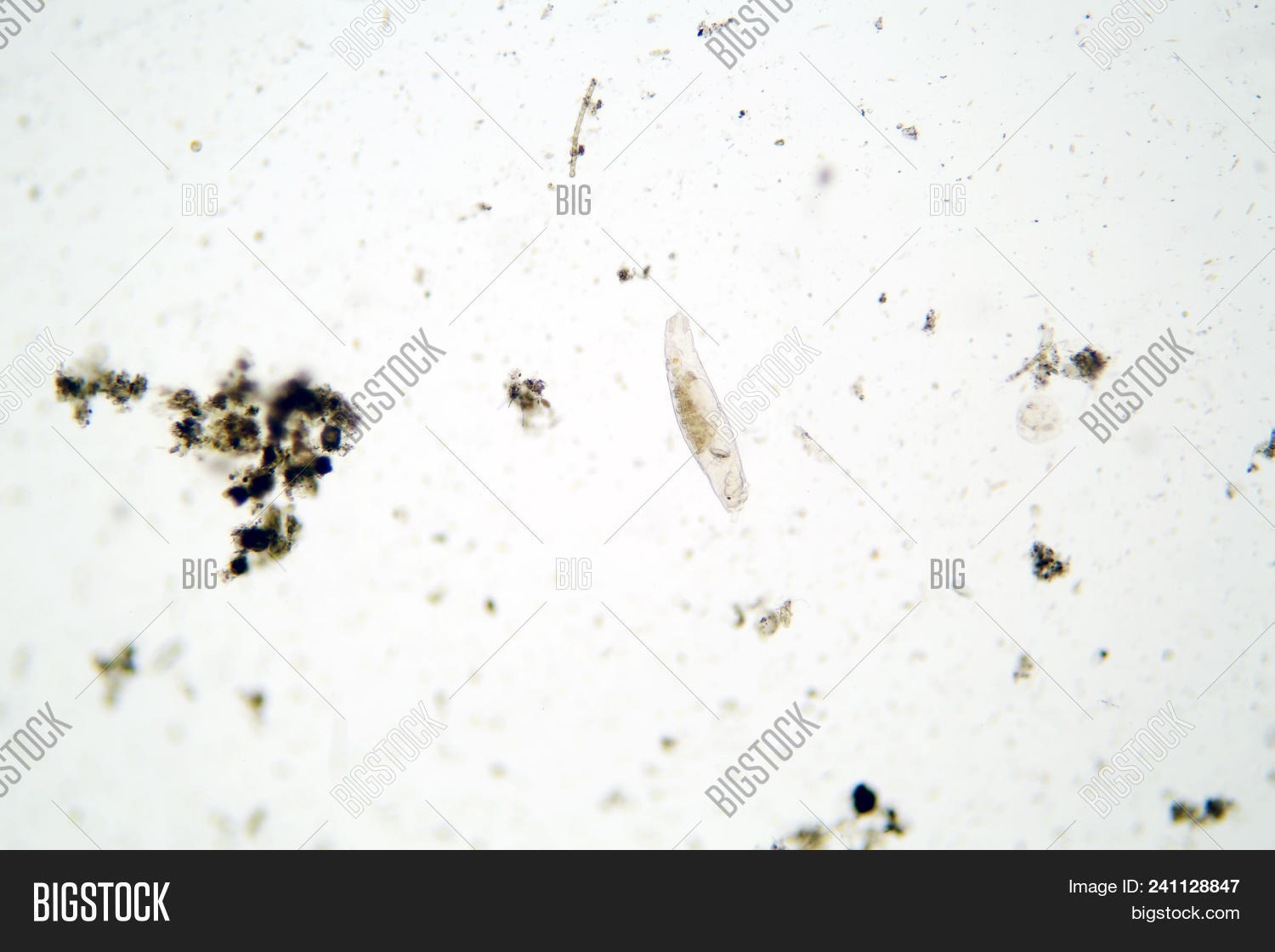 Microscopic Animals Image & Photo (Free Trial) | Bigstock