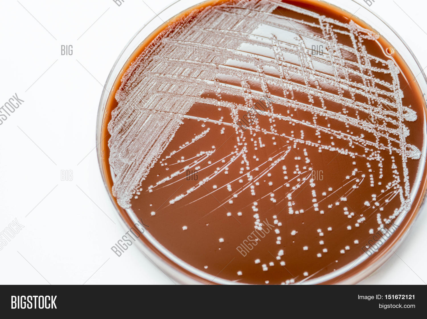 Bacterial Colonies Image & Photo (Free Trial) | Bigstock