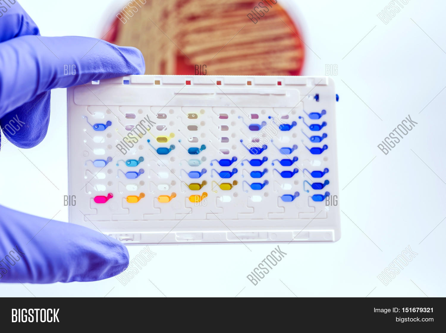 Reagent Strip Biochem Image & Photo (Free Trial) | Bigstock
