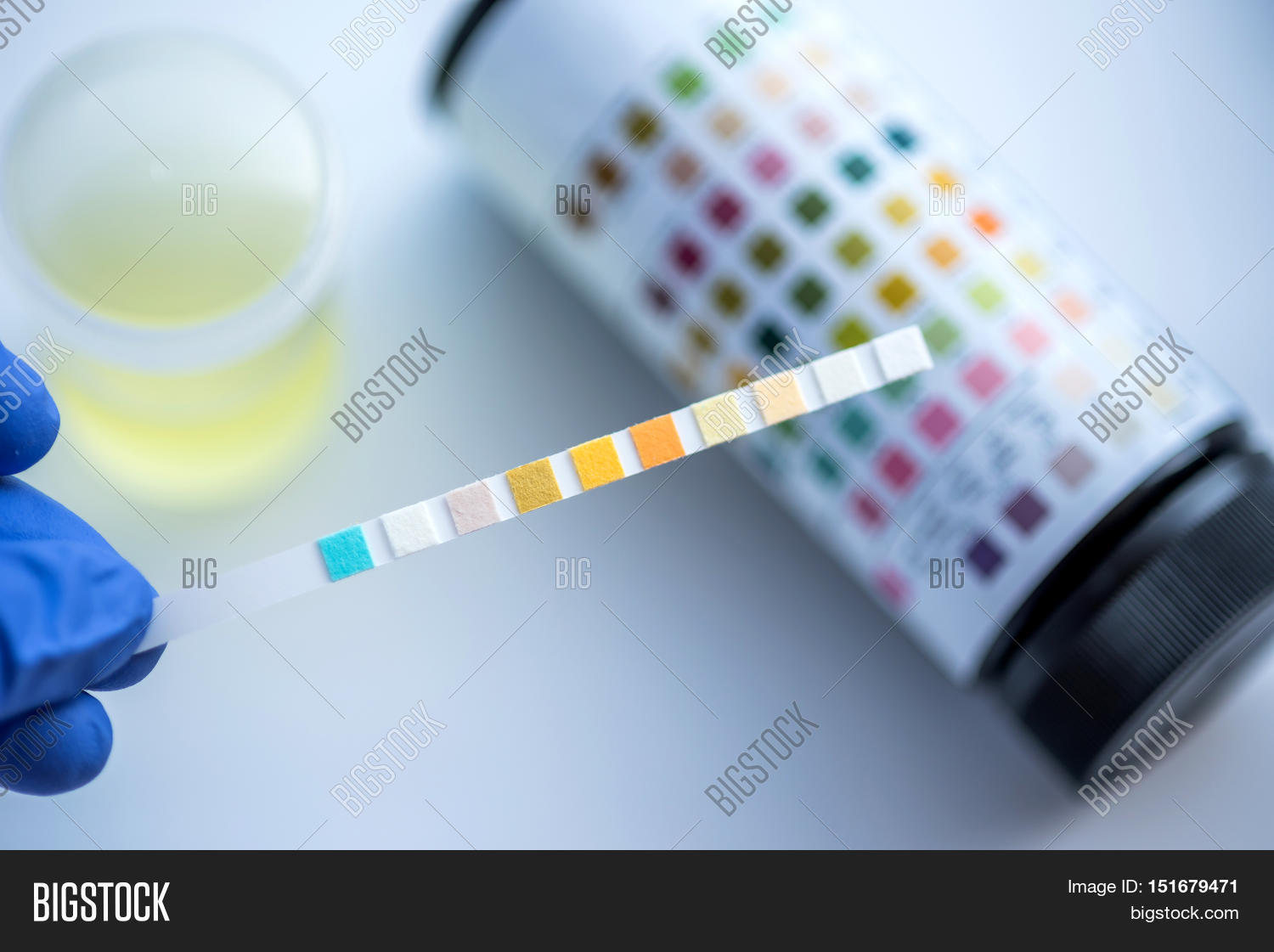 Reagent Strip Image & Photo (Free Trial) | Bigstock