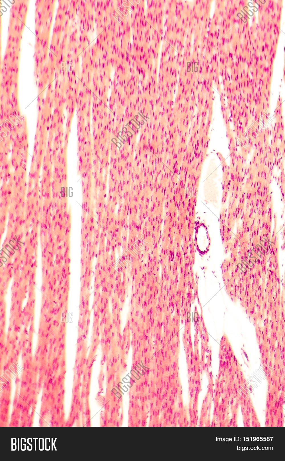 Heart Muscle, Light Image & Photo (Free Trial) | Bigstock