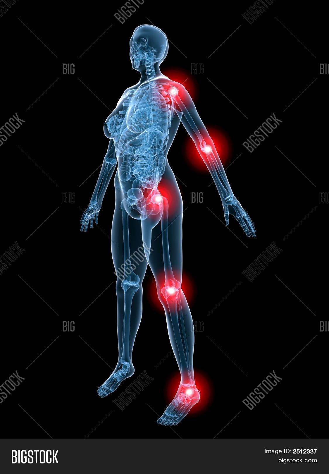 X-Ray Anatomy-Painful Image & Photo (Free Trial) | Bigstock