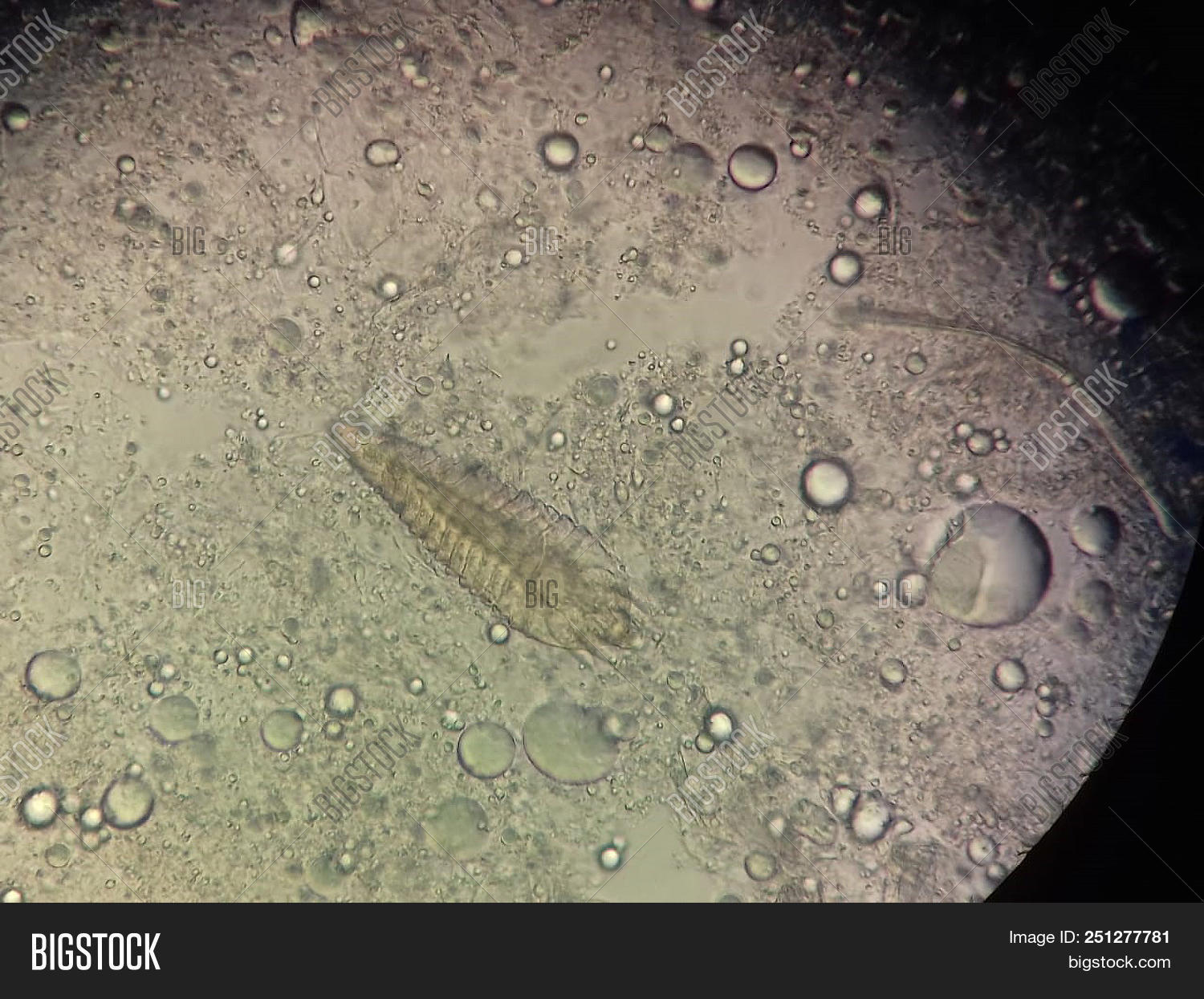 Demodex Parasite Under Image & Photo (Free Trial) | Bigstock