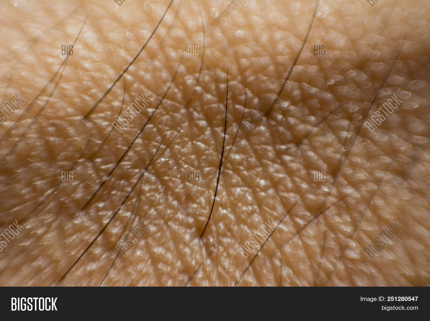 Human Skin Scales