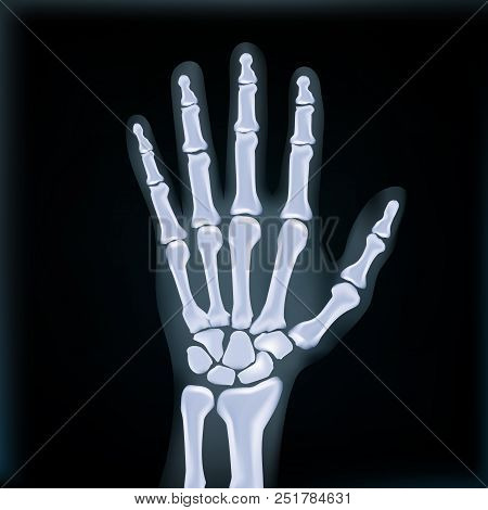 Realistic X-ray Hand Vector & Photo (Free Trial) | Bigstock