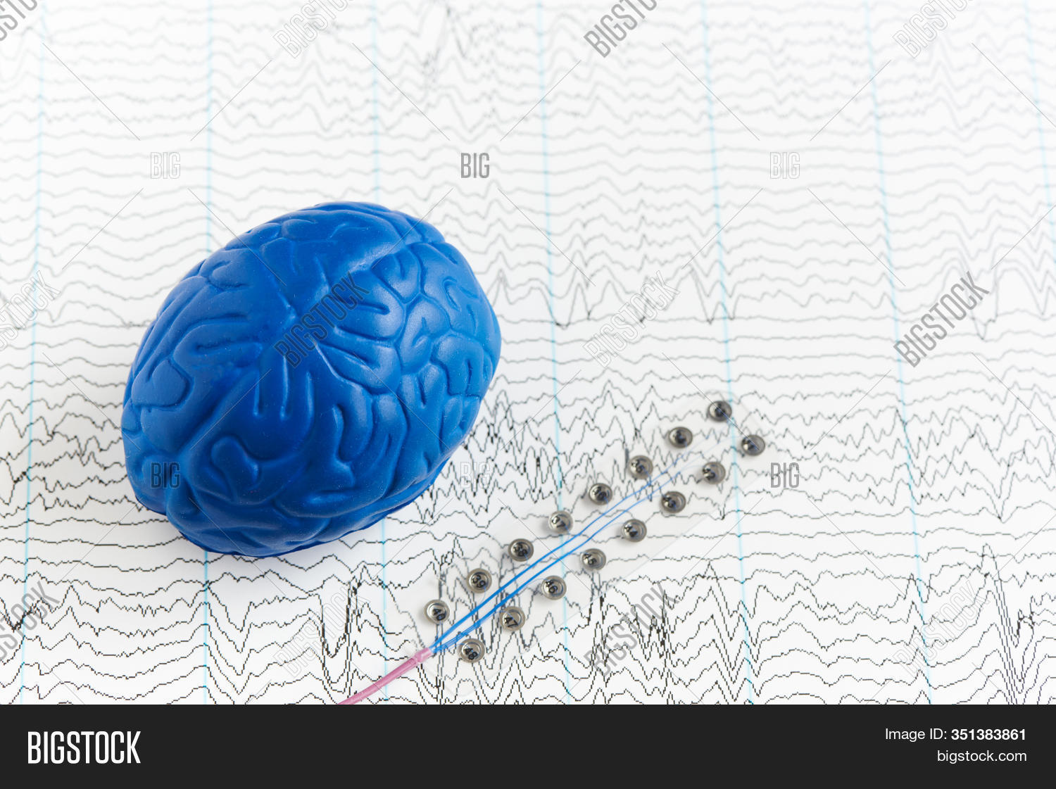 Subdural Grid Image & Photo (Free Trial) | Bigstock