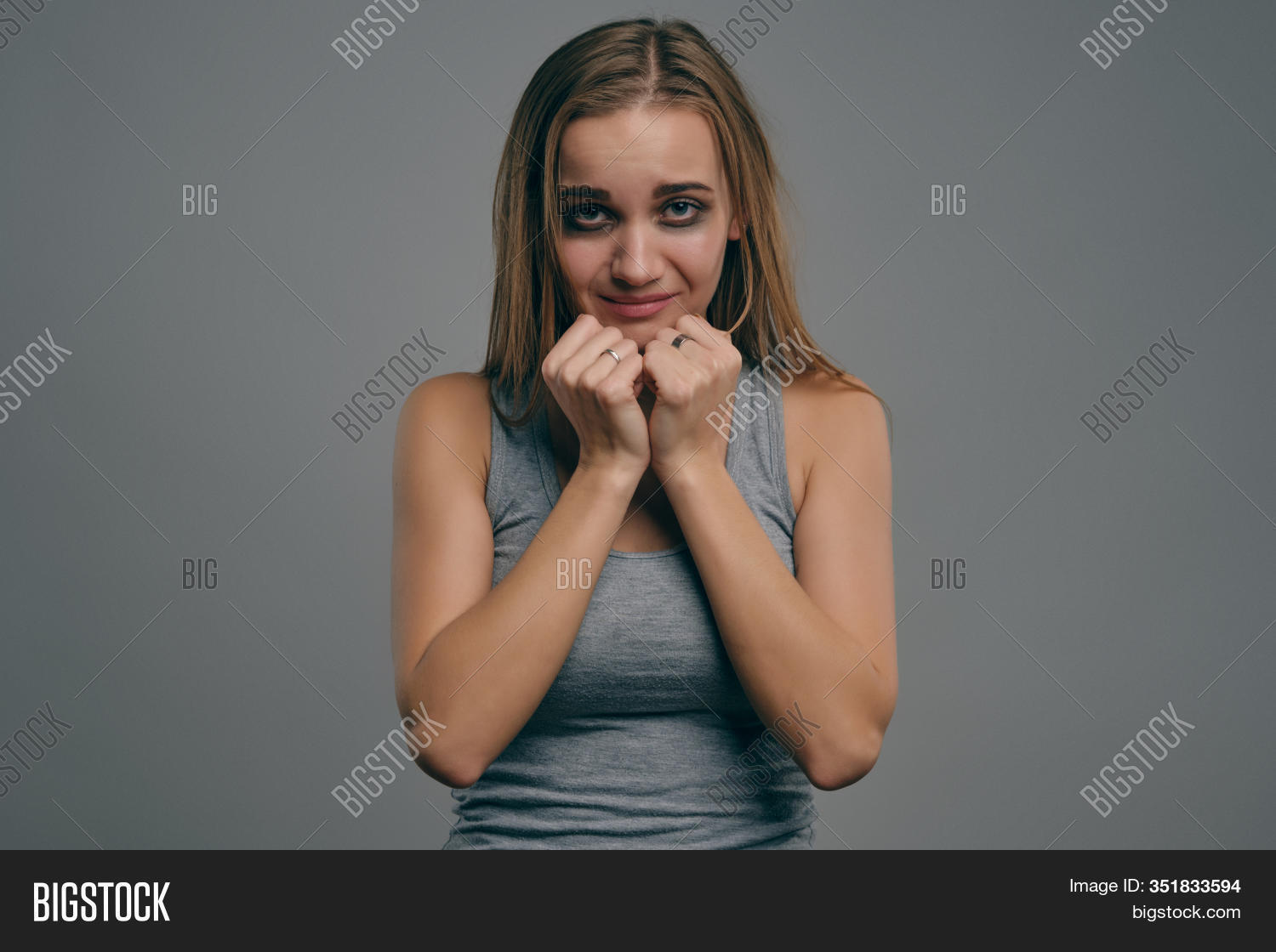 Blonde Girl Bruises On Image & Photo (Free Trial) | Bigstock
