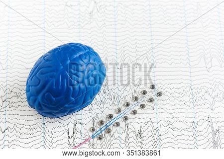 Subdural Grid Image & Photo (Free Trial) | Bigstock