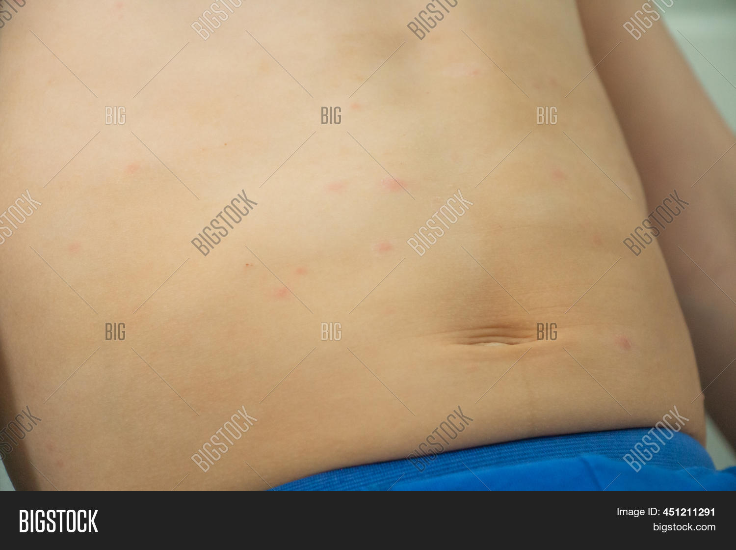Belly Child Affected Image & Photo (Free Trial) | Bigstock